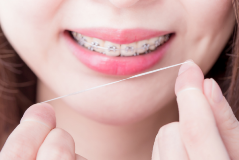 Uncomfortable Truths: Why Dental Floss Gets Stuck with Braces and How ...